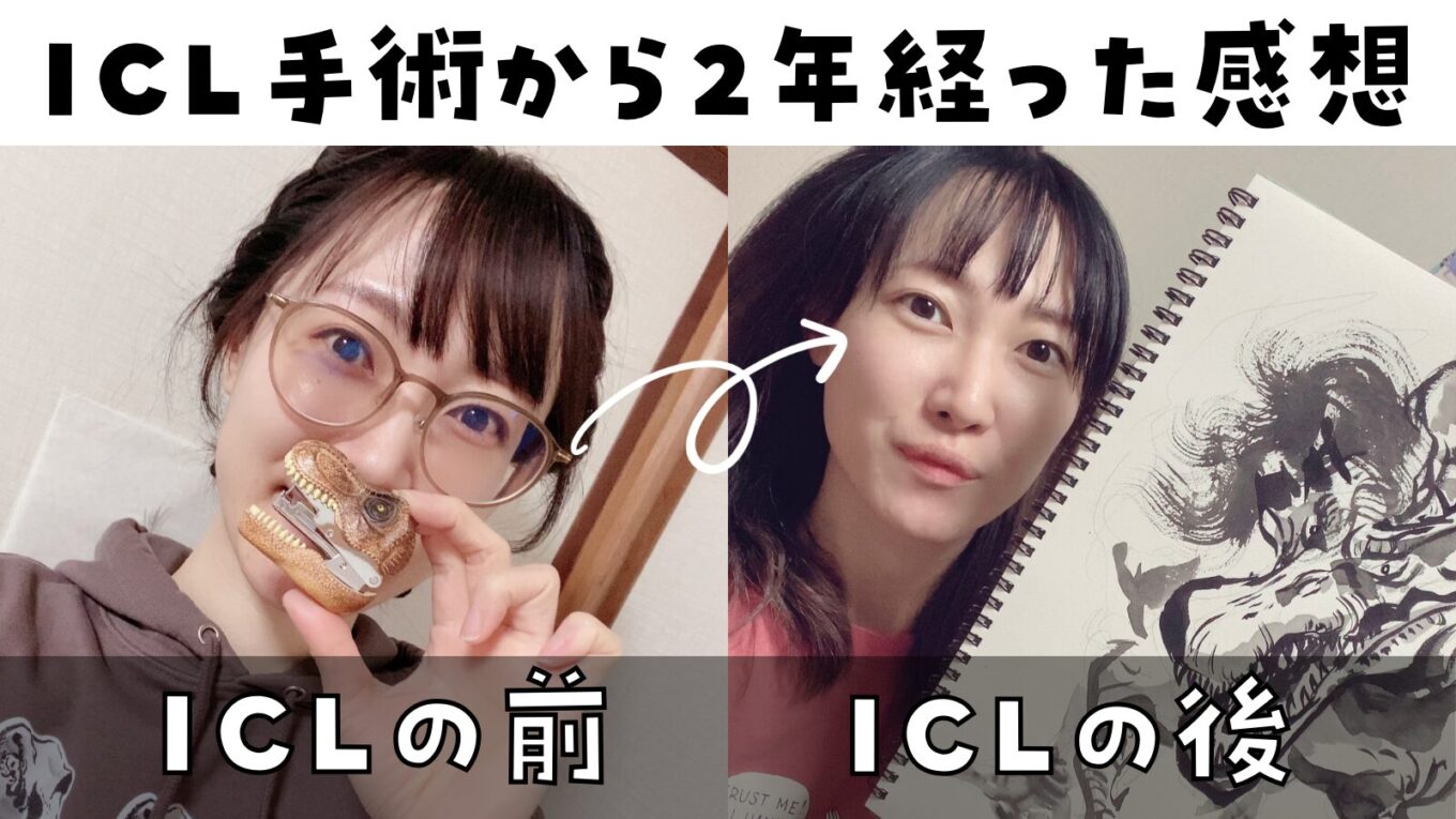 ICL手術当日の様子と2年経過後の感想【ICL体験談 フジモト眼科 | 大阪】恐竜画家CAN | 公式ブログ